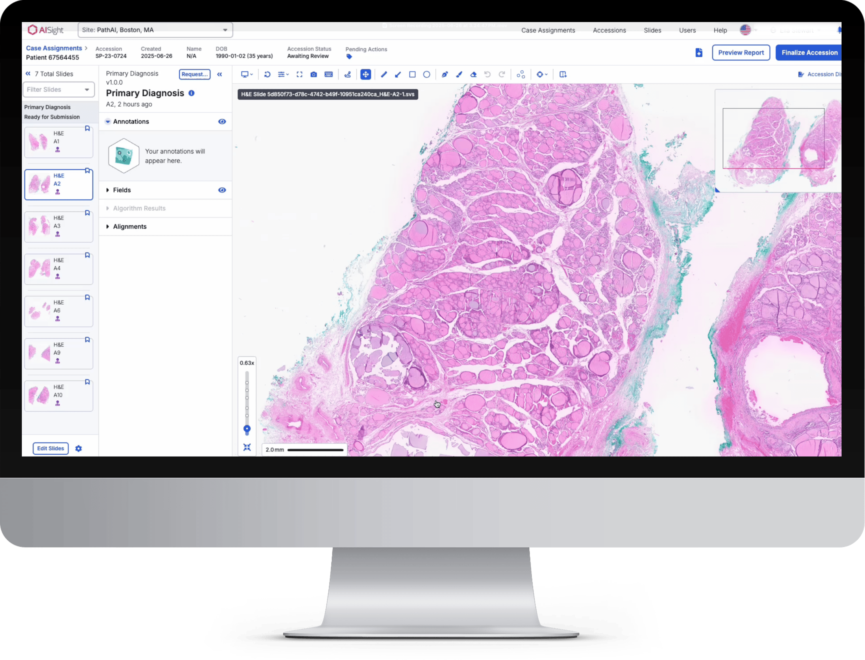 PathAI AISight Système de Gestion d'Images de Pathologie