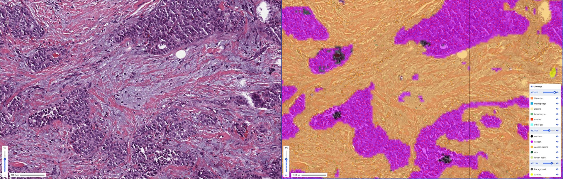 PathAI Announces Research Presentations at the San Antonio Breast Cancer Symposium